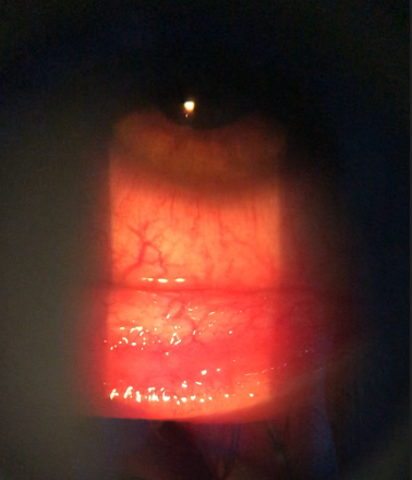 Eye Diseases - Belmont Eye